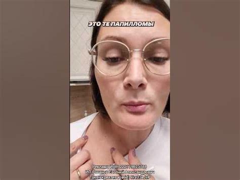 🤷‍♂Как избавиться от папилломы 🦠? #папилломы #шипица #бородавки # ...