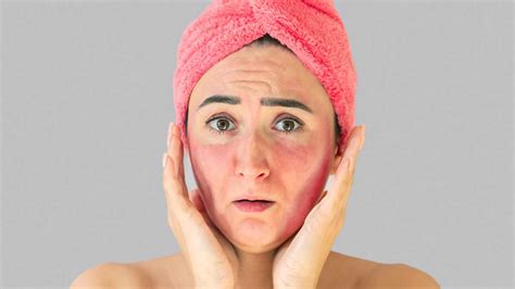 Which antihistamine is best for rashes? - Torrinomedica