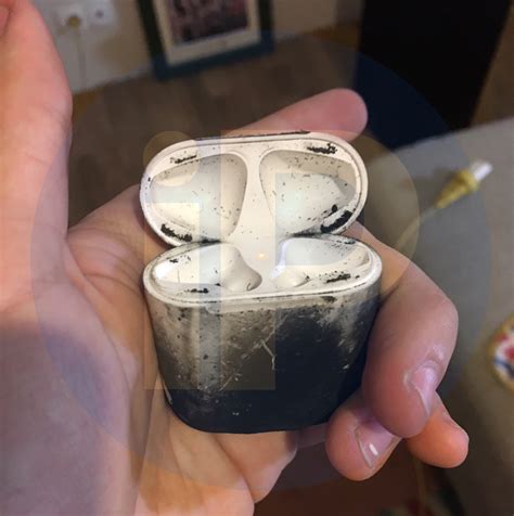 У белоруса взорвались AirPods прямо в кармане. Есть фото