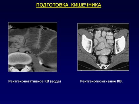 Компьютерная томография - презентация онлайн