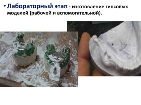 Искусственные коронки. Штампованная и цельнолитая металлические коронки ...