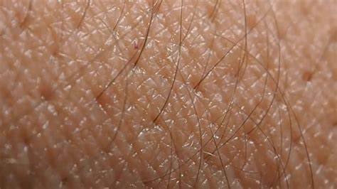 Derma Bilder – Durchsuchen 13,760 Archivfotos, Vektorgrafiken und ...