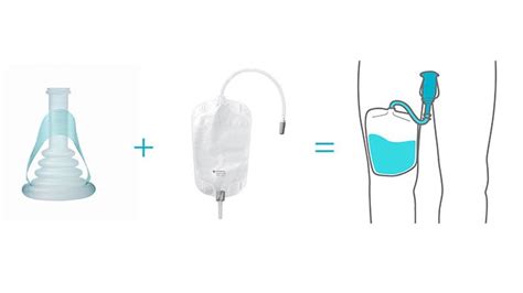 Lösning med urindroppsamlare och benpåsar