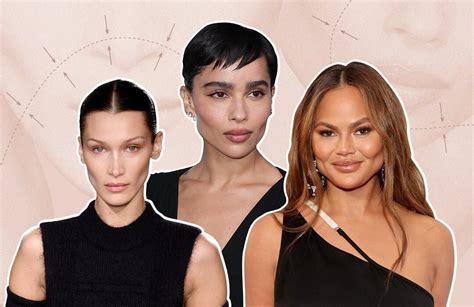 Buccal fat removal is the latest celebrity cosmetic surgery craze