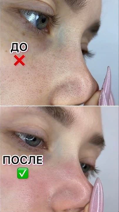 Черные точки тают на глазах🙀 #черныеточки #атоми #гидрофильноемасло # ...
