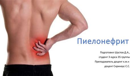 Пиелонефрит. Классификация - презентация онлайн