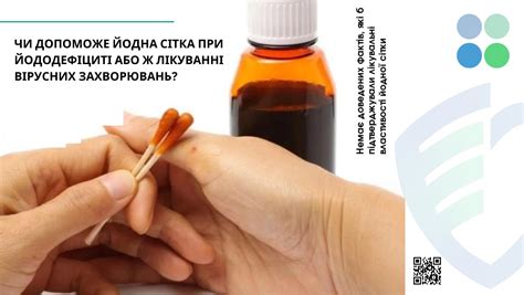 Чи допоможе йодна сітка при йододефіциті або ж лікуванні вірусних ...