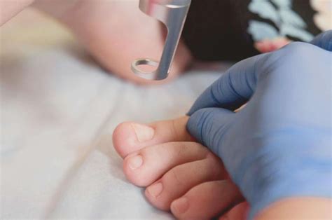 Fungal Nail Treatment Kent | Canterbury Skin and Laser Clinic