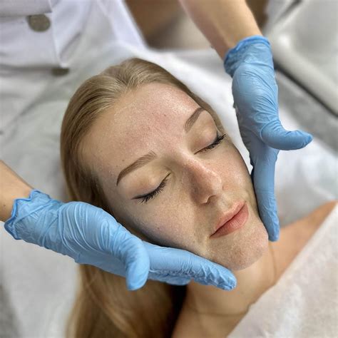 Пилинг PRX-T33 в Симферополе • Mezo Clinic