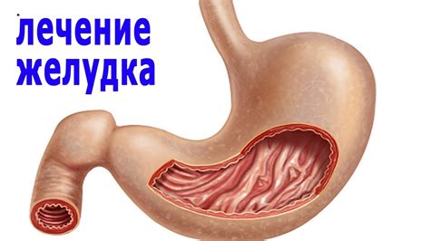★Как лечить желудок в домашних условиях. Питание при болезнях желудка ...