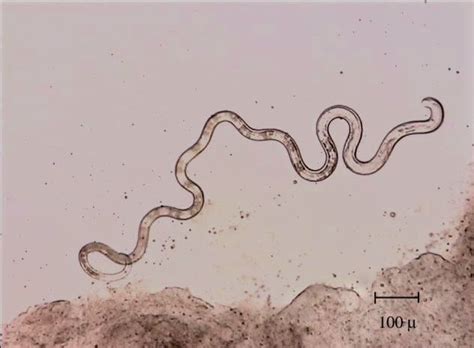 Nematodes (White Worms) In The Aquarium | Prevention