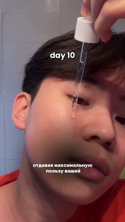 САМАЯ ПОПУЛЯРНАЯ КОРЕЙСКАЯ СЫВОРОТКА ОТ АКНЕ И ПОСТАКНЕ🔥 - YouTube