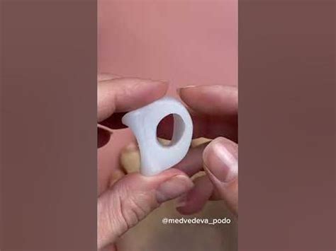 Разгрузка мозоли #подология #ноготочки #онихолизис #гиперкератоз # ...