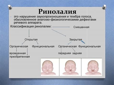 Ринолалия в логопедии. что это такое, определение, причины ...