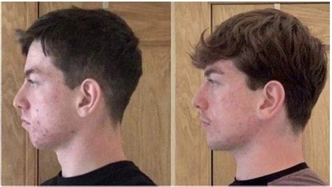 Mewing Blog: tutorials, step-by-step guides, tips and tricks to get a strong jawline