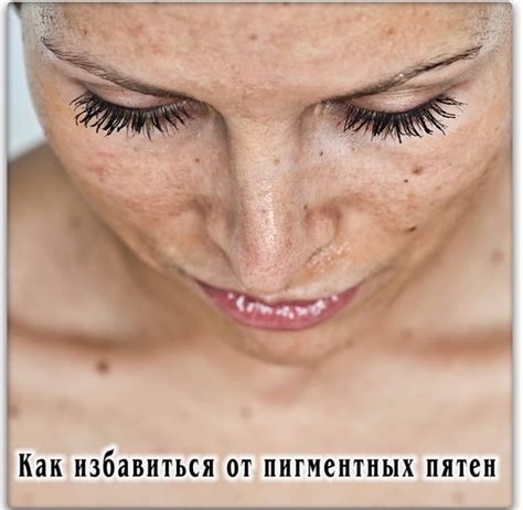 Как избавиться от пигментных пятен Что делать, если Вы хотите осветлить ...