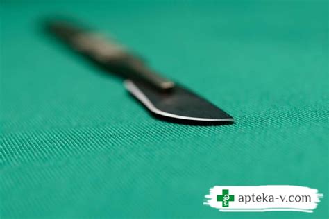 Обрезание крайней плоти у мужчин, цена, отзывы после операции