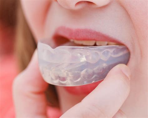 Mouthguard