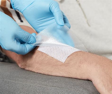 Silflex – Advancis Medical