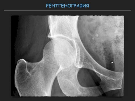 Визуализация тазобедренного сустава