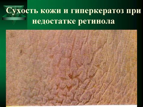 Питание и здоровье. Методы, формы и средства гигиенического обучения и ...
