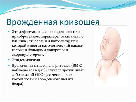 Врожденная мышечная кривошея - презентация онлайн