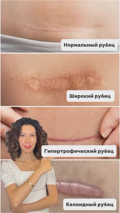 Асель Маркабаева (@asselmarkabayevamd) • Instagram photos and videos