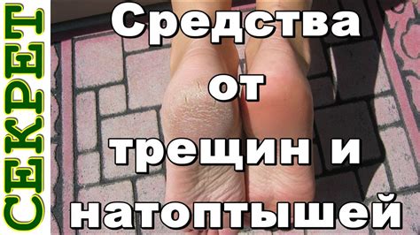 Как убрать мозоли и вылечить трещины на пятках - YouTube