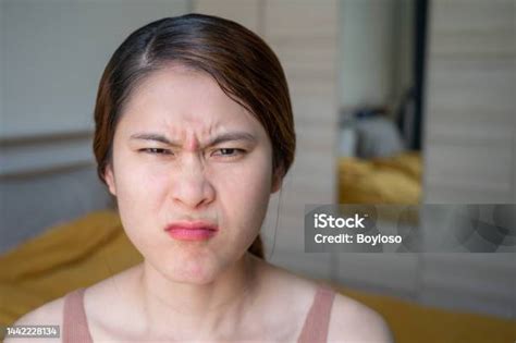 Portrait Of Unhappy Asian Woman With Skin Problem Such As Acne Scar ...