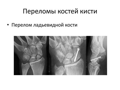 Повреждения кисти и предплечья - презентация онлайн