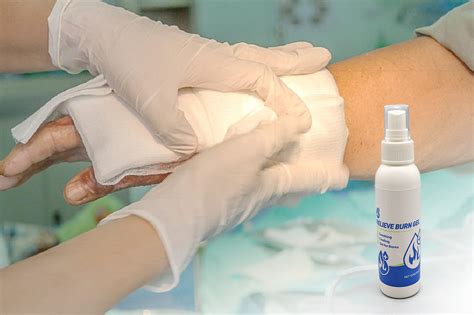 Sterile 120ml Spray Relieve Burn Gel Emergency Burn Care Wounds Care ...