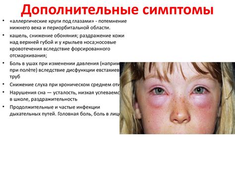 Аллергический ринит у детей - презентация онлайн