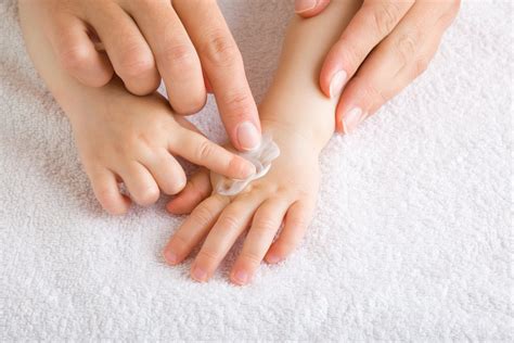 Чем лечить лишай у детей: мази и другие препараты | MedAboutMe