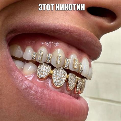 Создать мем "грилзы брекеты, грилзы бриллиантовые, грилз" - Картинки ...