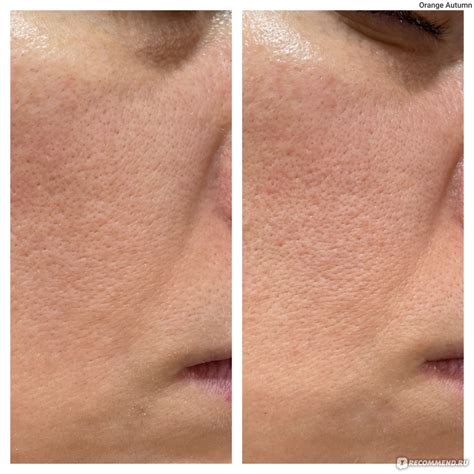 Крем для лица ARAVIA Balance moisture cream с 10% мочевиной и ...
