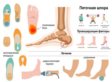 Что такое шпора кратко
