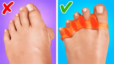 Expert Hacks and Tips for Healthy and Beautiful Feet 🦶 - YouTube