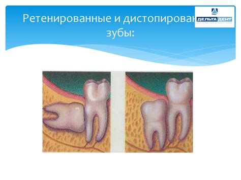 Понятная стоматология - презентация онлайн