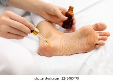 Young Womans Hand Applies Moisturizing Nourishing Stock Photo ...
