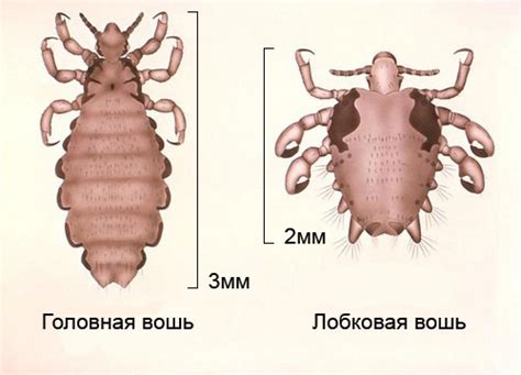 Лечение лобковых вшей в домашних условиях