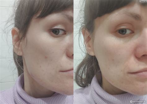 Пенка для умывания LovLuv очищающая с гиалуроновой кислотой, 50мл ...