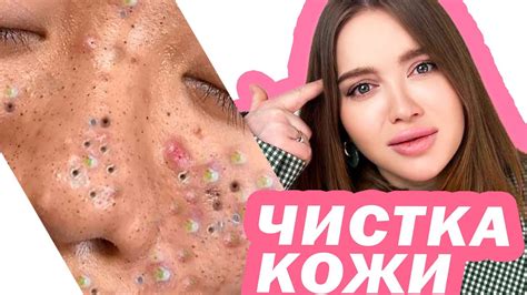ЧИСТКА кожи ЛИЦА! ДОМА сделай САМ как ПРОФЕССИОНАЛ! - YouTube