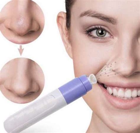 Вакуумный очиститель пор Spot Cleaner: отзывы реальные, цена