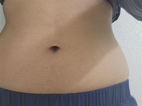 Is this hirsutism? This has bothered me my entire life. : r/Hirsutism