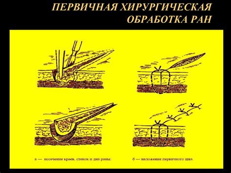 Уход за ранами у хирургических больных - презентация онлайн