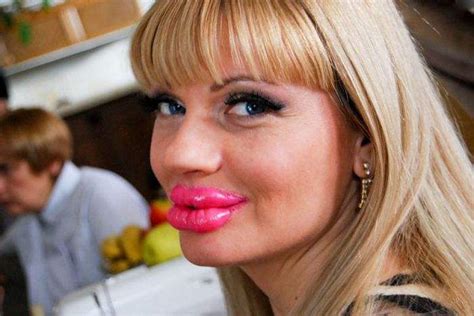 HONESTLY? Your LIPS Look RIDICULOUS! Silicone Nightmares - TheCount.com