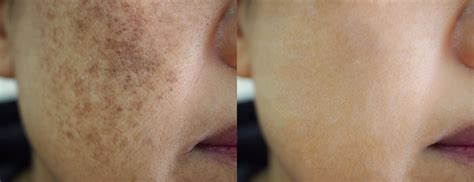 Obaji Systems – Hannah Aesthetic Clinic