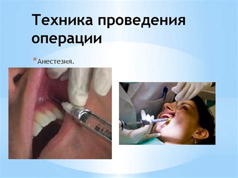Основы имплантации в стоматологии - презентация онлайн