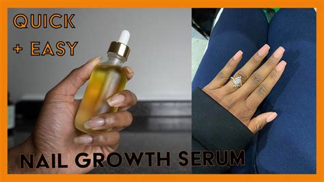 Quick and Easy D.I.Y NAIL GROWTH SERUM for long, strong and healthy ...