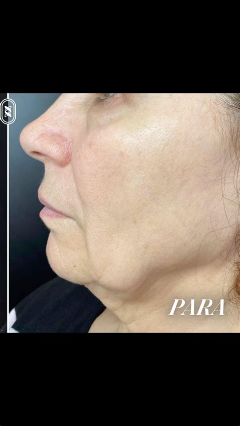 Jamber | Jamber by Neo Dr offers a sophisticated solution for jawline ...